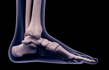 Identifying and Treating Chronic Ankle Instability | Los Angeles, CA